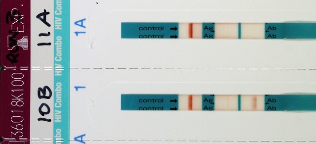 HIV antibody and antigen testing - HIV Management Guidelines