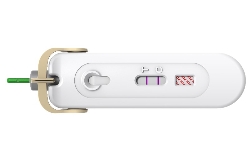 HIV antibody and antigen testing - HIV Management Guidelines