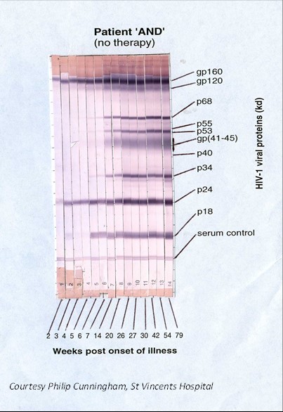 HIV antibody and antigen testing - HIV Management Guidelines HIV antibody and antigen testing - HIV Management Guidelines
